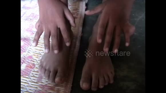 Indonesian family have 12 fingers and 12 toes - Buy, Sell or Upload ...