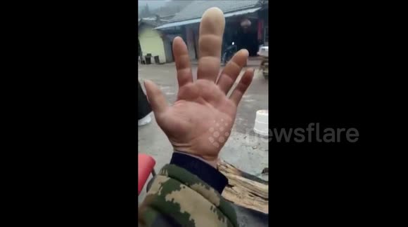 Man in China's Sichuan shows off his massive finger - Buy, Sell or ...