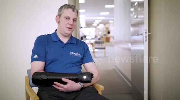 UK dad becomes first military veteran in the world to receive a 3D ...