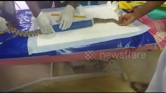Injured python given plaster cast in southern Indian hospital - Buy ...