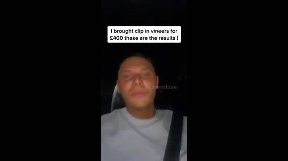 Man with CLIP-IN VENEERS mercilessly mocked by TikTok users comparing ...
