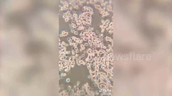 US student captures mesmerising videos of snails, tooth plaque and ...