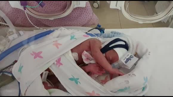 One of Britain's tiniest babies born at 1lb 4oz survived after being ...