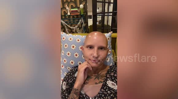 "I have alopecia and had a double mastectomy - I refused reconstruction ...