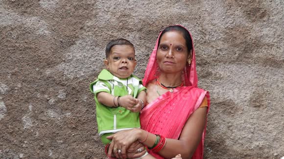 Meet the 25-year-old Indian man who is one of the smallest people on ...