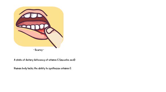 Scurvy (Vitamin C Deficiency) - Causes, Risk Factors, Signs & Symptoms ...