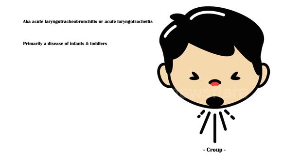 Croup - Causes, Pathogenesis, Signs & Symptoms, Diagnosis, & Treatment ...