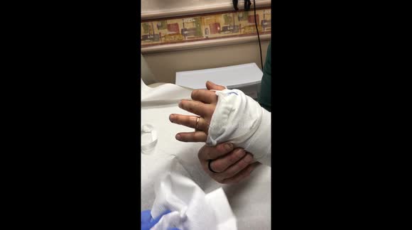 Surgeon's ring removal technique at University of Utah hospital goes ...