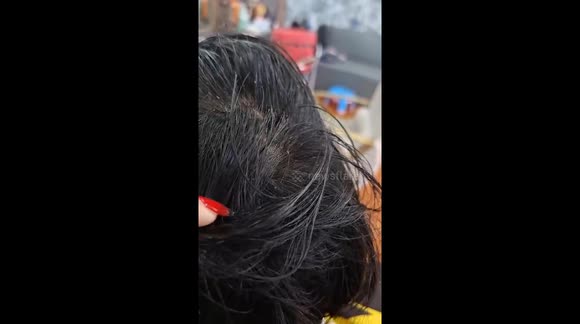 Schoolgirl with extreme lice infestation finally has his head shaved ...