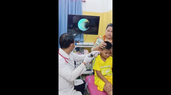 Doctor finds live cockroach in ear canal of toddler complaining of ...