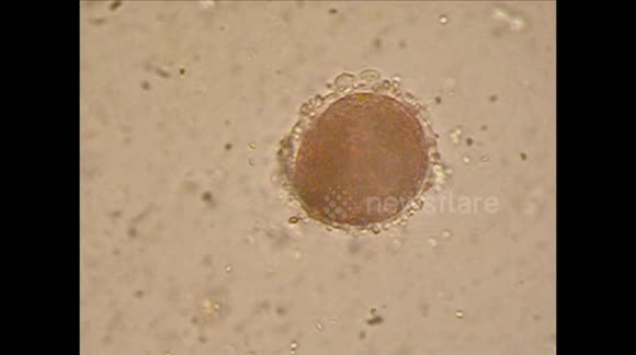 Multiple sperm cells swarming around a single egg cell and finally ...
